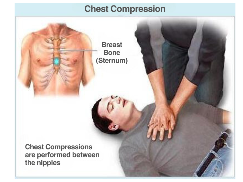 CPR and First Aid - Page 3 | CPR Select